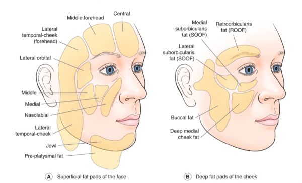 Autologous Fat Transfers - Dr Hamilton