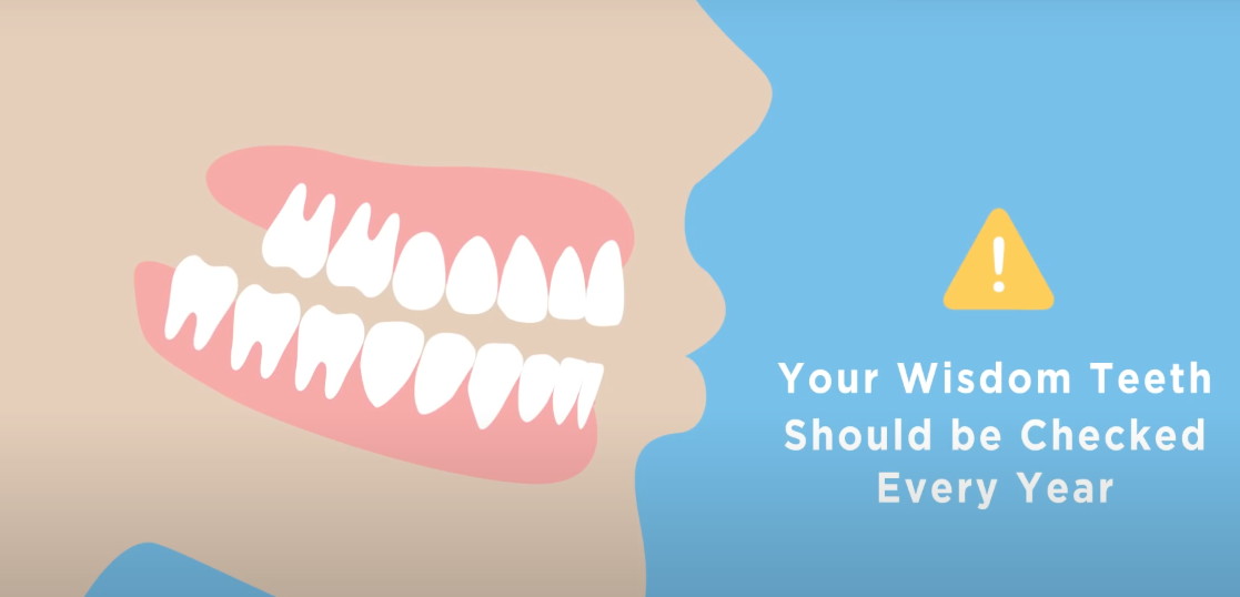 Exposure of Impacted Teeth - Dr Hamilton