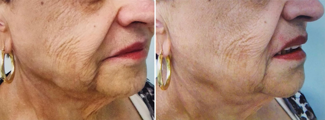 LASER Rejuvenation & Therapies - Dr Hamilton